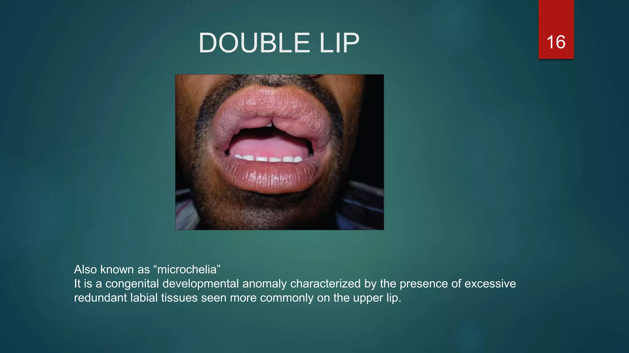 Development of Face Part 1 | PPTX