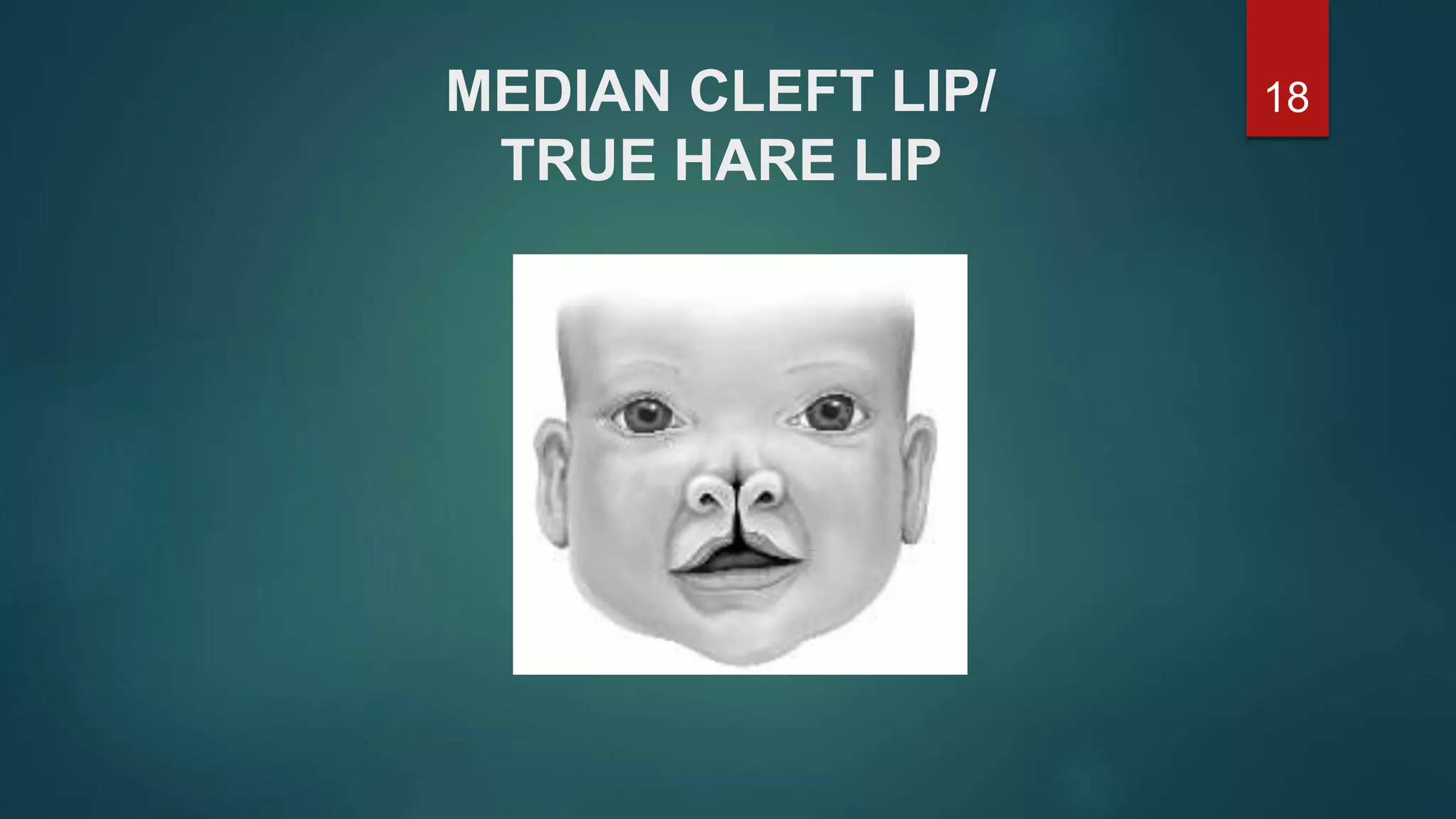 Development of Face Part 1 | PPTX