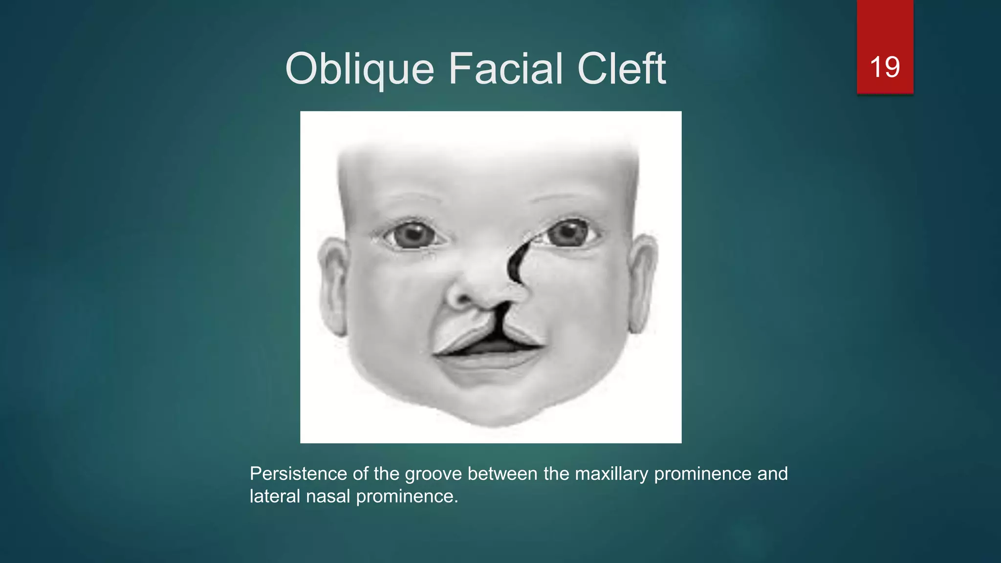 Development of Face Part 1 | PPTX