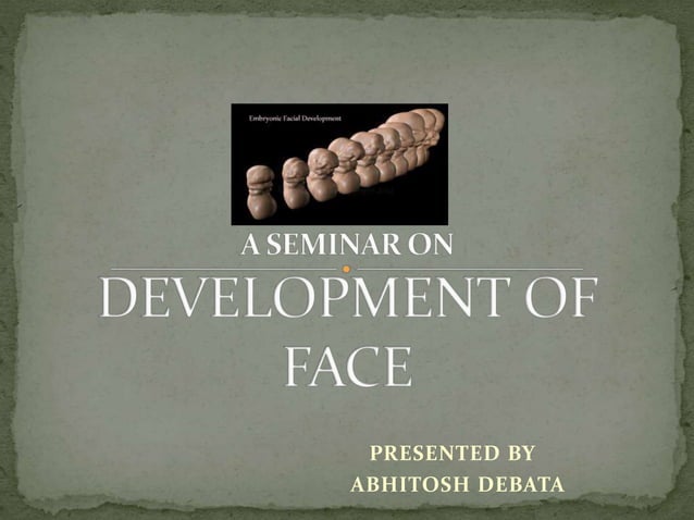 Development of face & Developmental anomalies | PPTX