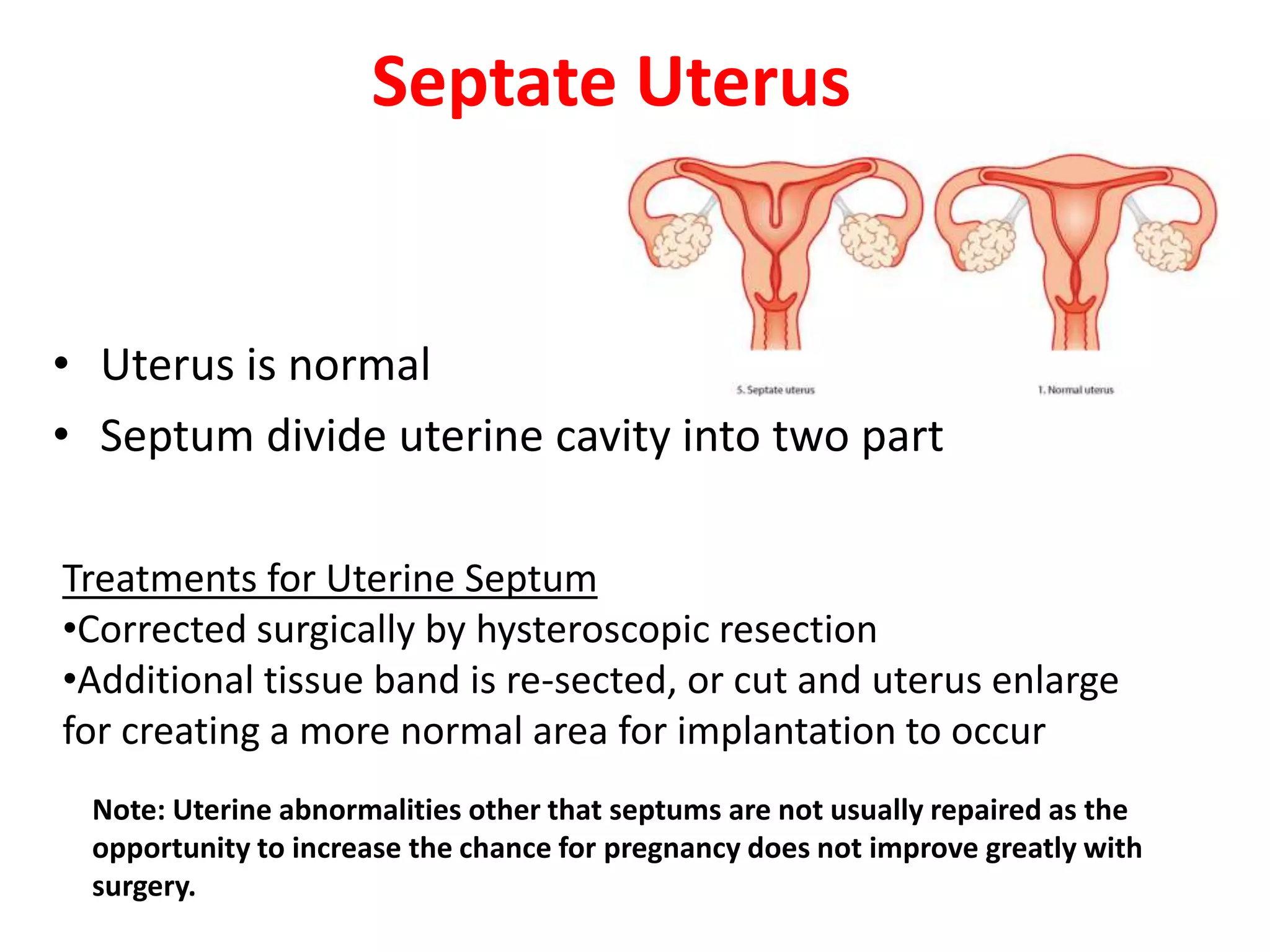 Development of Female Reproductive system.pptx