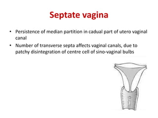 Development of Female Reproductive system.pptx