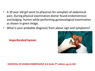 Development of Female Reproductive system.pptx