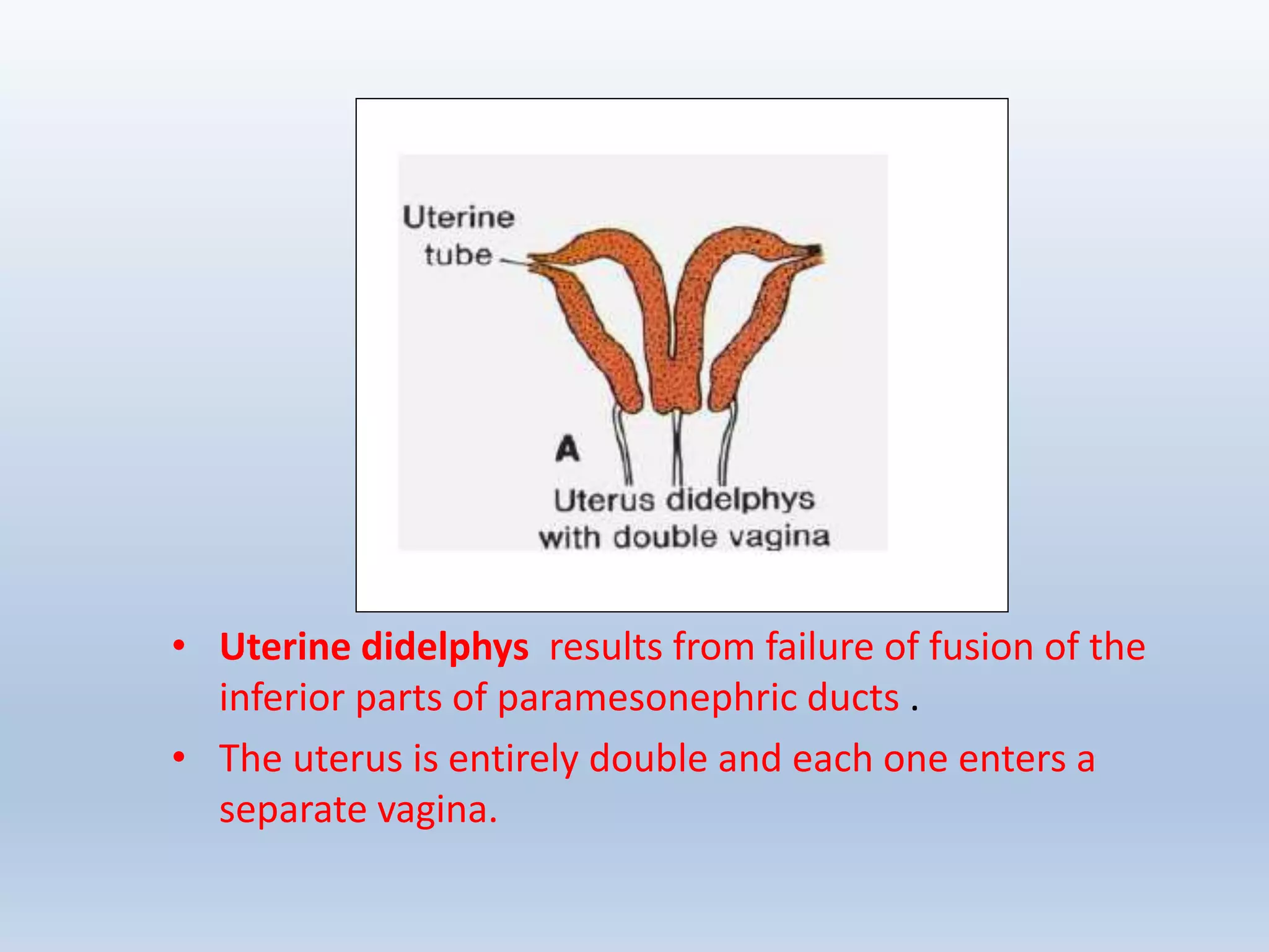 Development of female reproductive system | PPTX