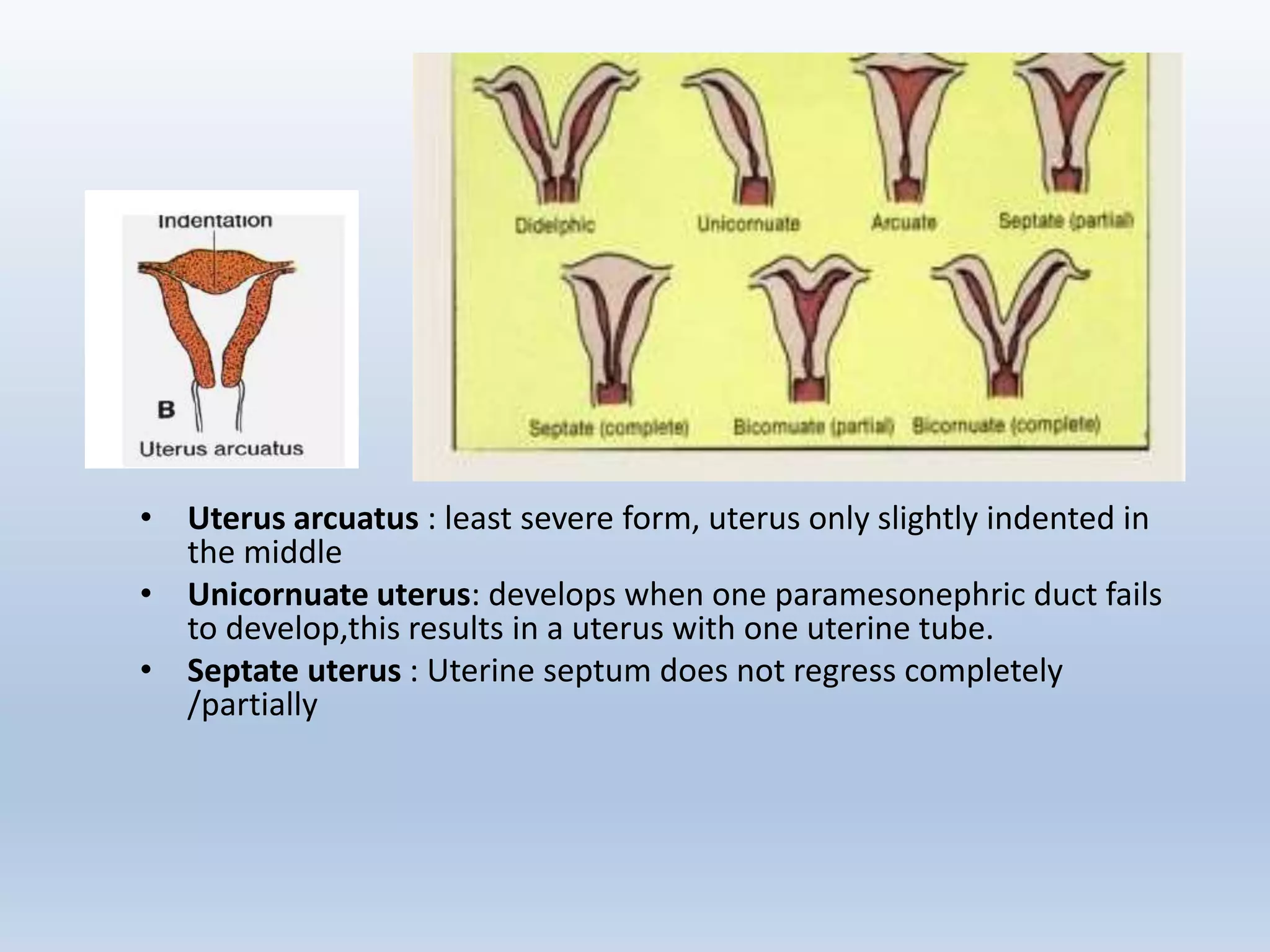 Development of female reproductive system | PPTX