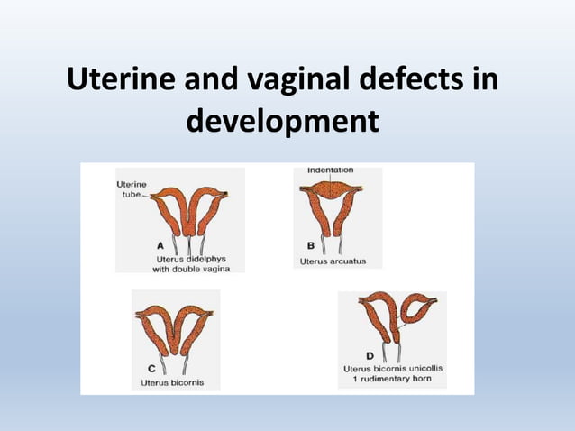 Development of female reproductive system | PPTX | Reproductive Health ...