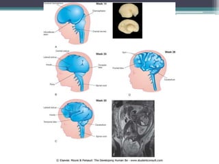 Development of forebrain by DR.ARSHAD | PPTX