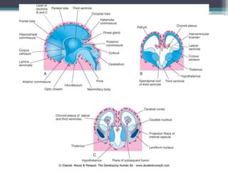 Development of forebrain by DR.ARSHAD | PPTX