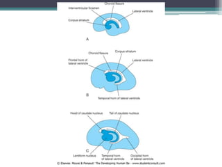 Development of forebrain by DR.ARSHAD | PPTX