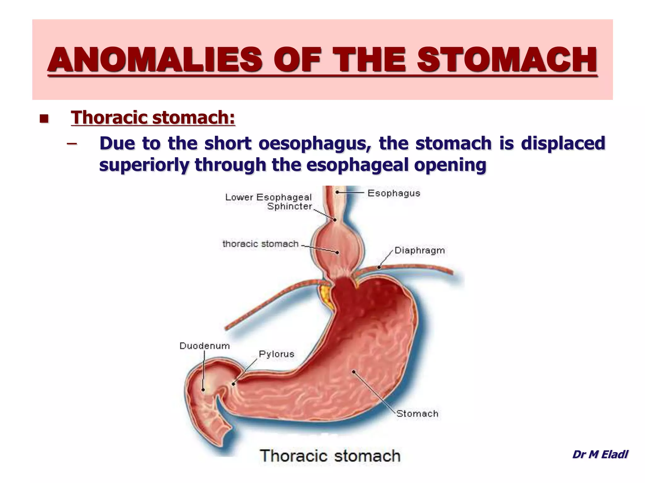 Development of foregut | PPTX