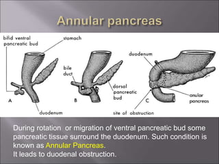 Development of FOREGUT MIDGUT AND HINDGUT.ppt