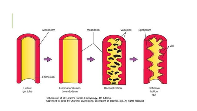 Development of GIT | PPTX | Digestive Disorders | Diseases and Conditions