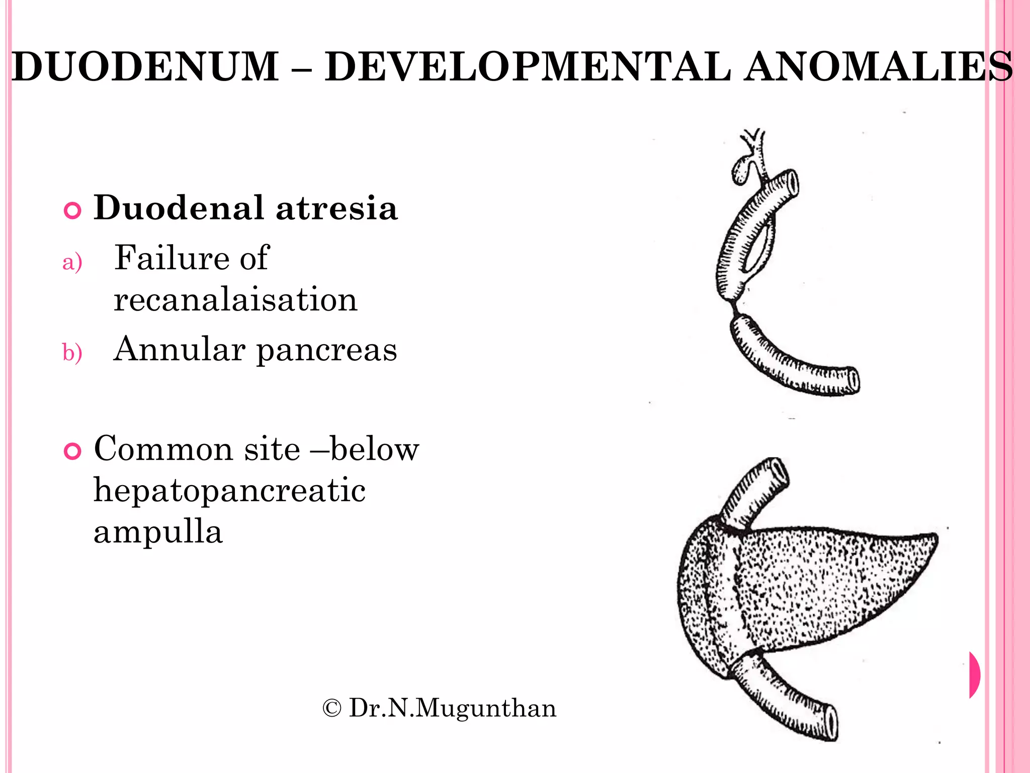 Development of Gastrointestinal system & its associated developmental ...