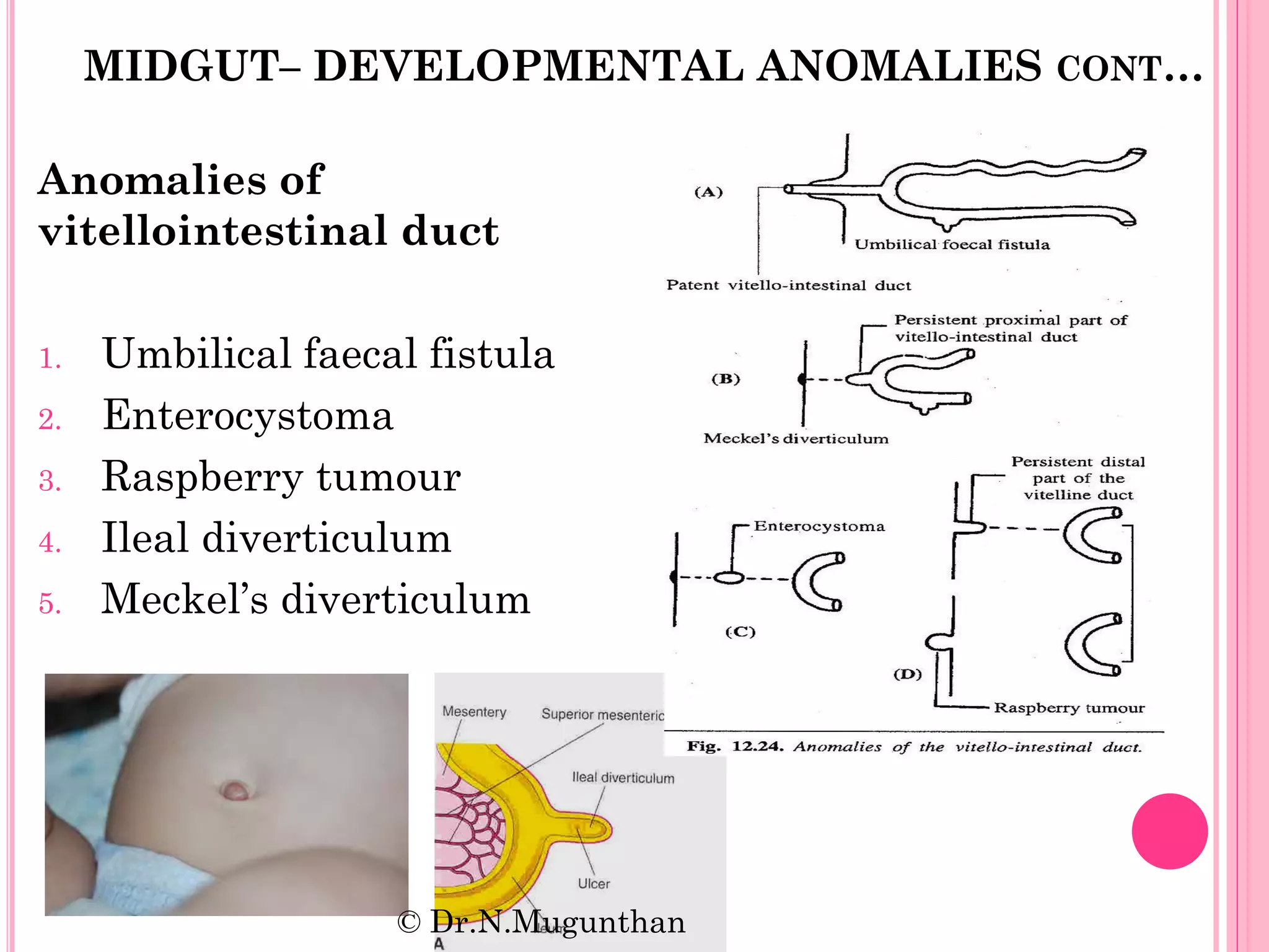 Development of Gastrointestinal system & its associated developmental ...