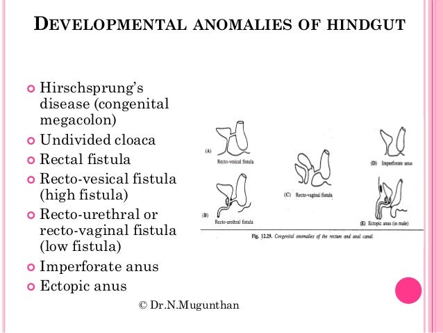 Development Of Gastrointestinal System And Its Associated Development