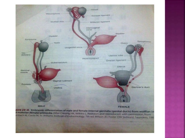 Development of gonads | PPTX | Reproductive Health | Diseases and ...