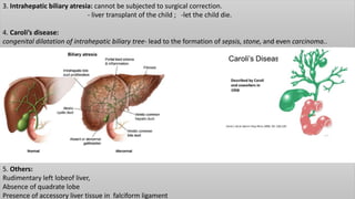 Development of Hepatobiliary System | PPTX
