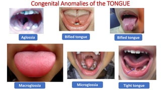 Development of head and neck | PDF
