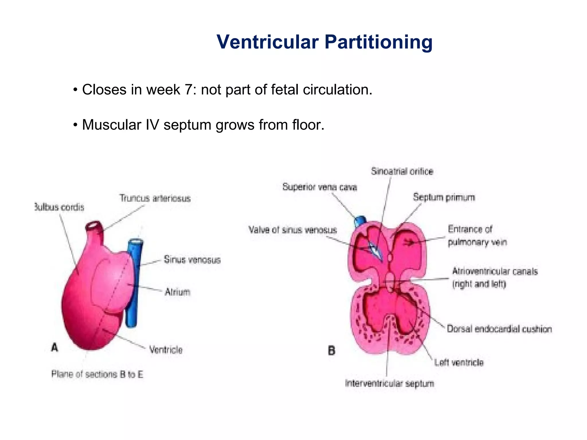 Development of heart | PPT