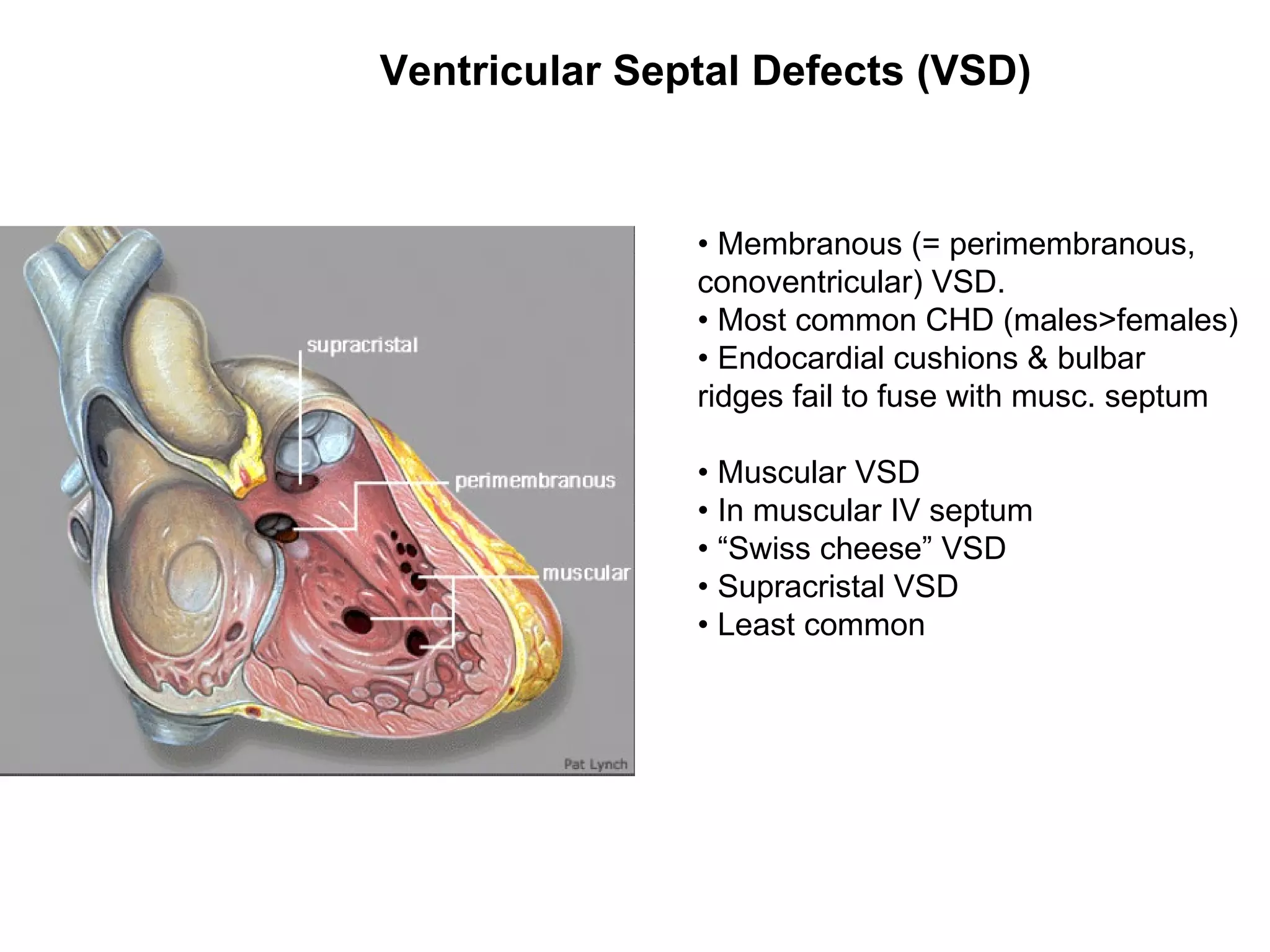 Development of heart | PPT