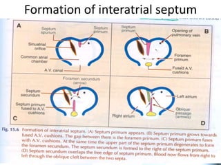 Interatrial Septum Heart Model