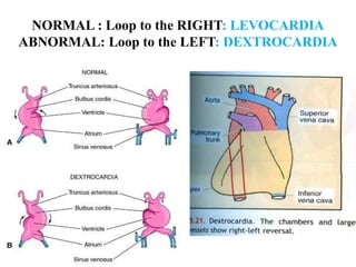 Development of heart | PPT
