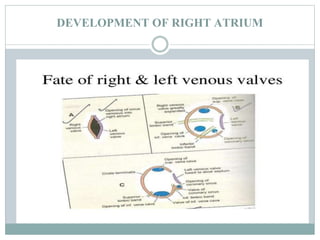 Development of Heart and Fetal circulation | PPT