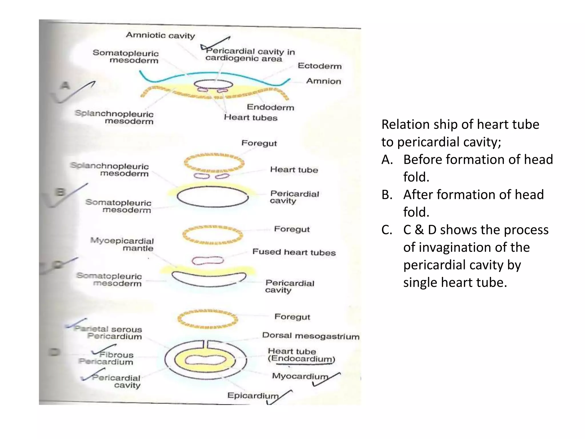 Development of heart ,,embryology,,virbhan | PPTX