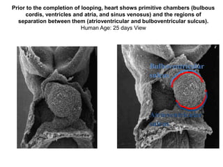 Development of heart ,,embryology,,virbhan | PPTX