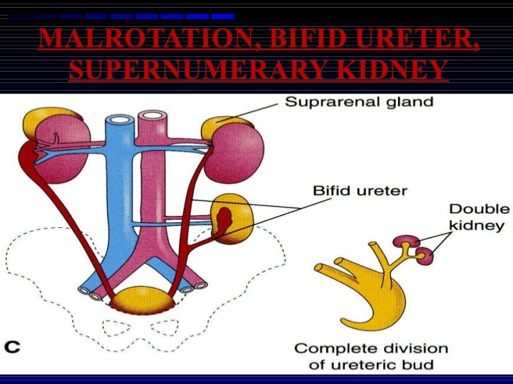Development of kidney and ureter 05.01.12