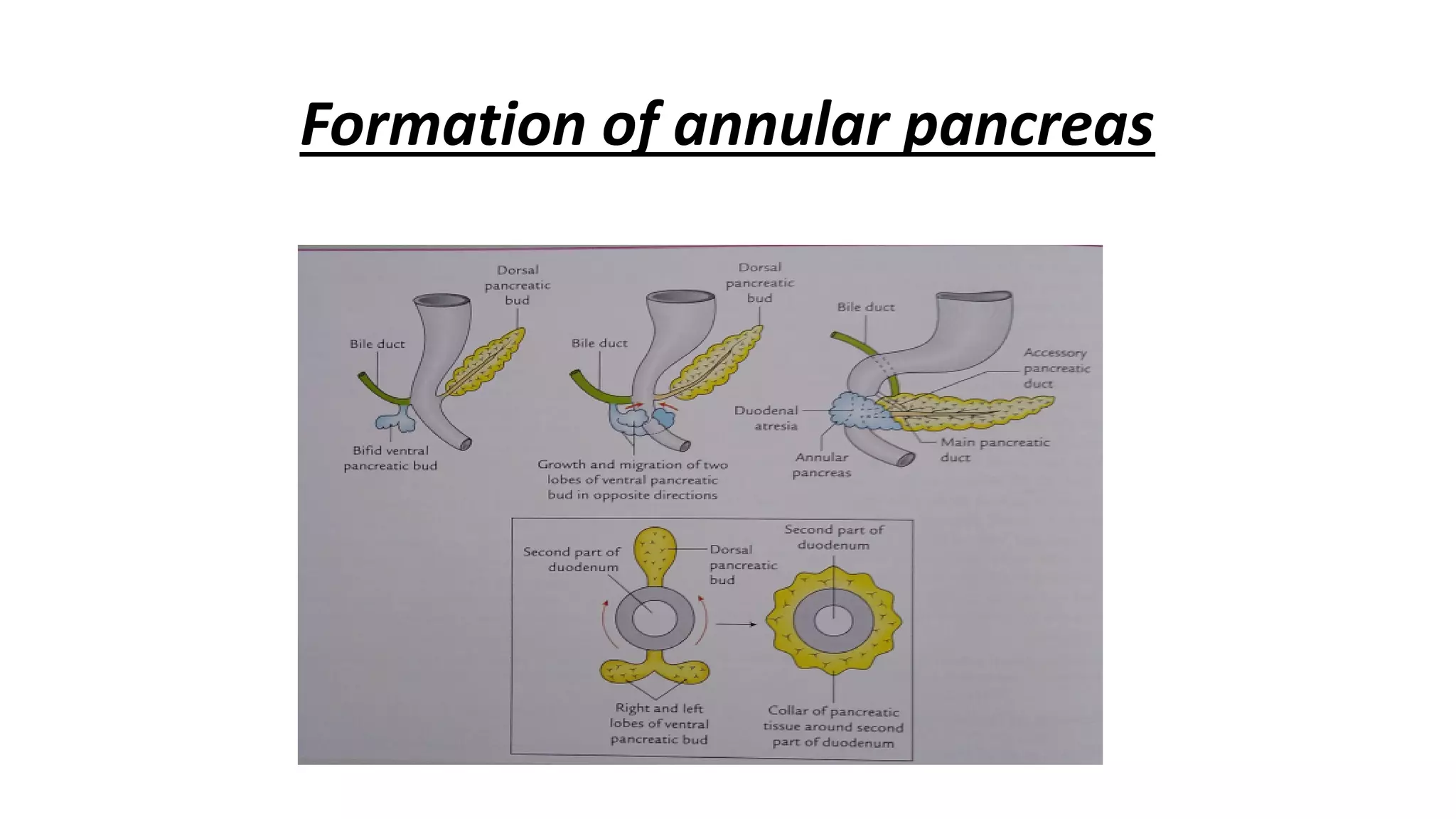Development Of Liver , Extrahepatic Biliary Apparatus , Pancreas And 