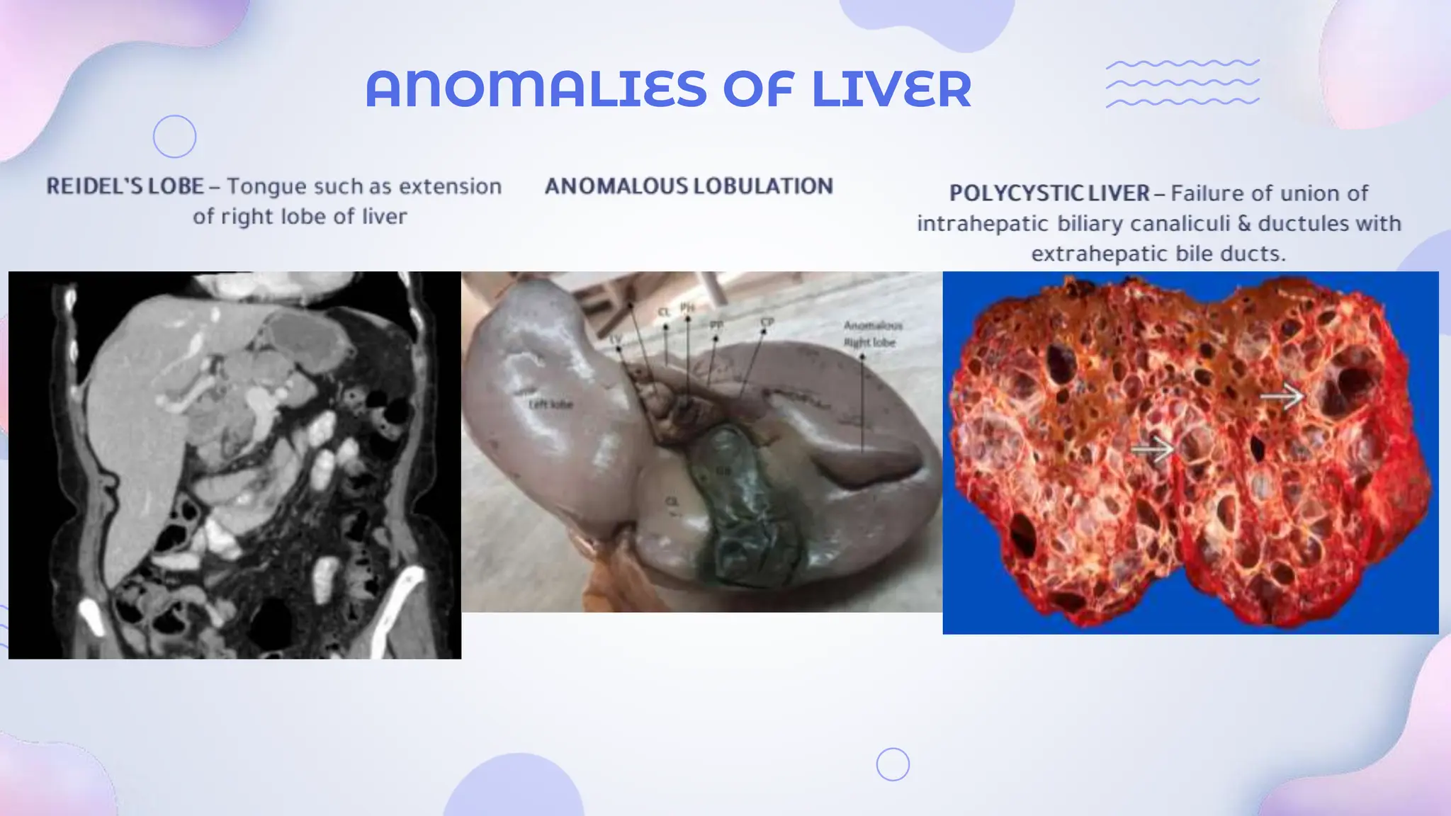 Development of liver, pancreas & spleen - ROLL NO. 38.pptx