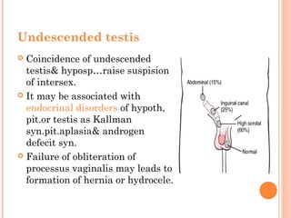Development of male genital system | PPT