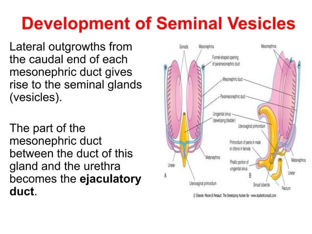 Development of male genital system (MBBS) | PPTX