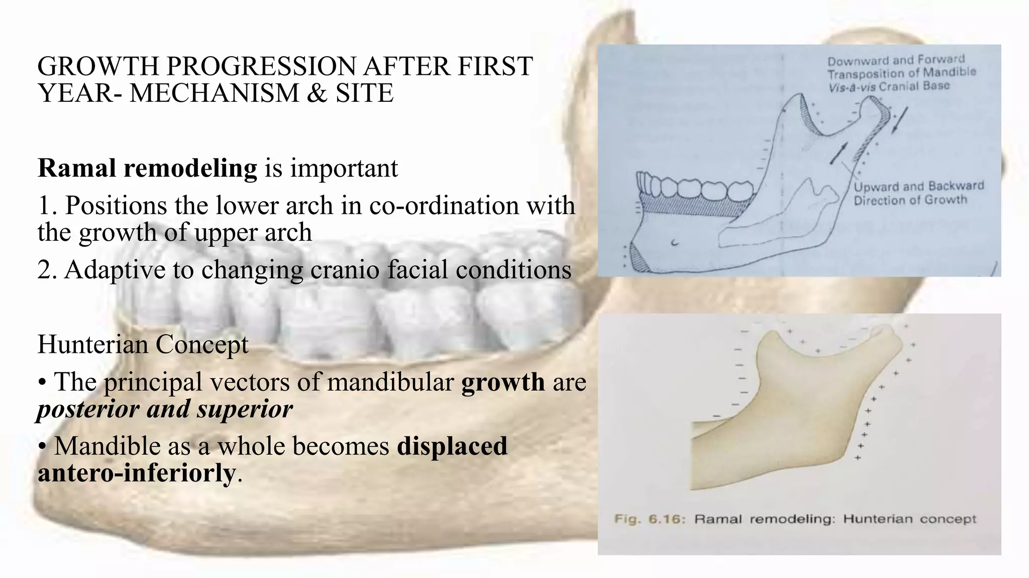 Development of mandible - Dr. Shweta Yadav - Oral and Maxillofacial ...
