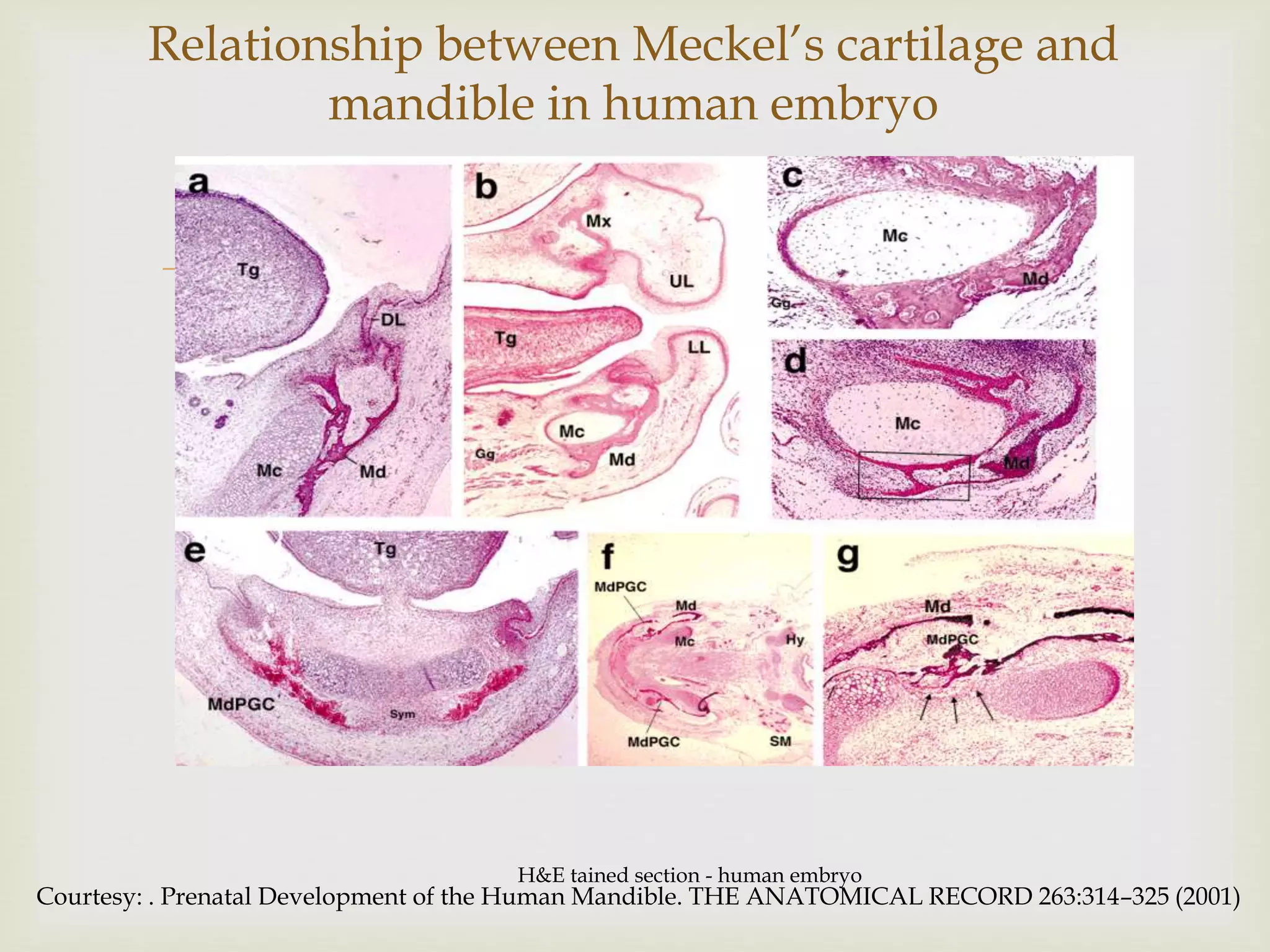 Development of mandible ppt | PPTX