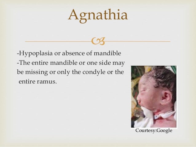 Development of mandible ppt