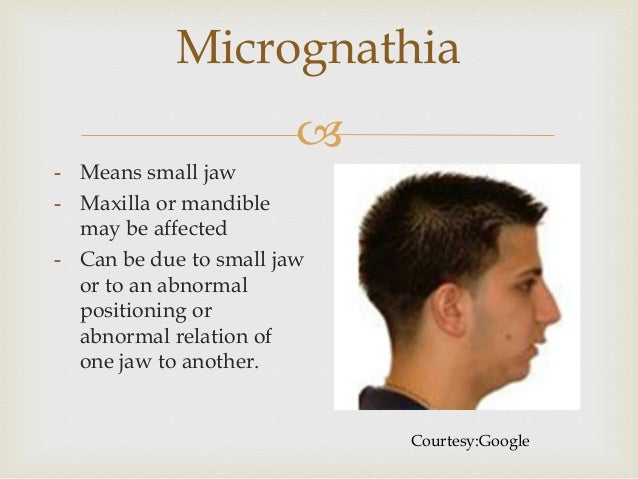 Development of mandible ppt