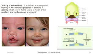 The development of the mandible and the temporomandibular joint | PPTX