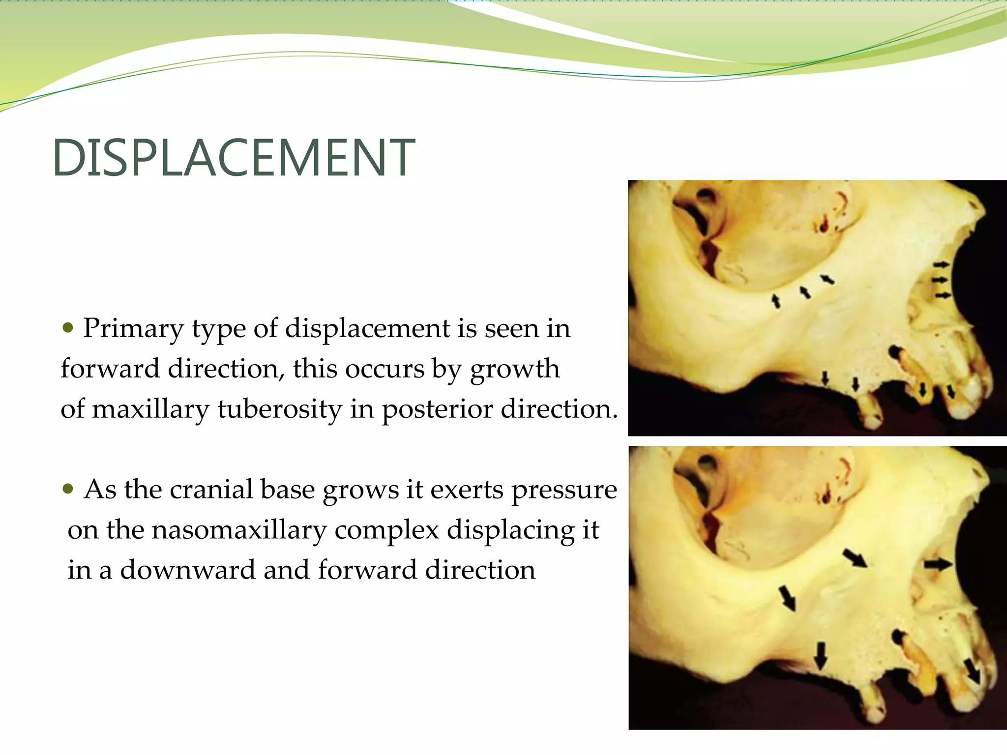 Development of maxilla | PPTX