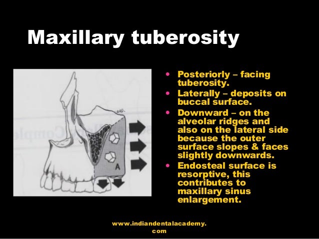Development of maxilla & palate
