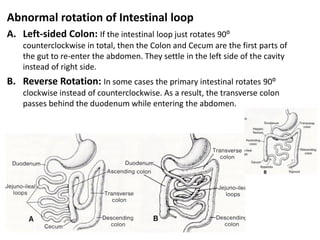 Development of midgut and pancreas | PDF