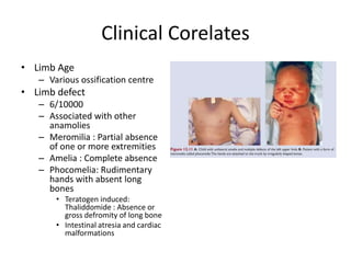 Development of Musculoskeletal system | PPTX