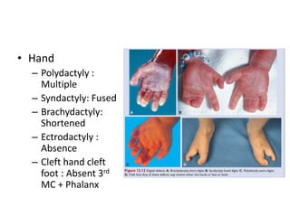 Development of Musculoskeletal system | PPTX