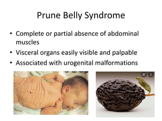Development of Musculoskeletal system | PPTX