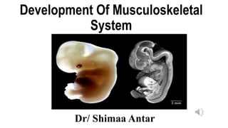 Development of Musculoskeletal system.ppsx