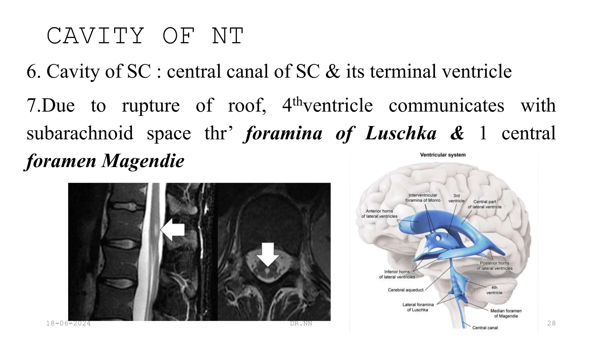 DEVELOPMENT OF NEURAL TUBE & SPINAL CORD.pptx