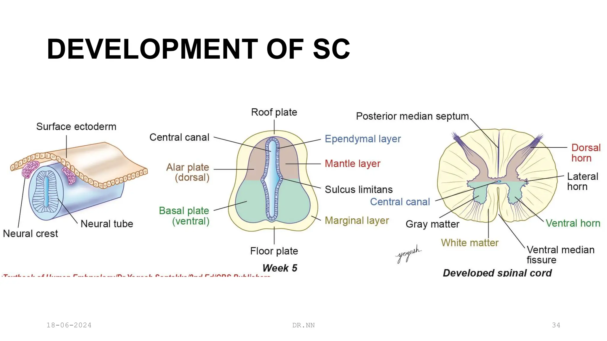 DEVELOPMENT OF NEURAL TUBE & SPINAL CORD.pptx