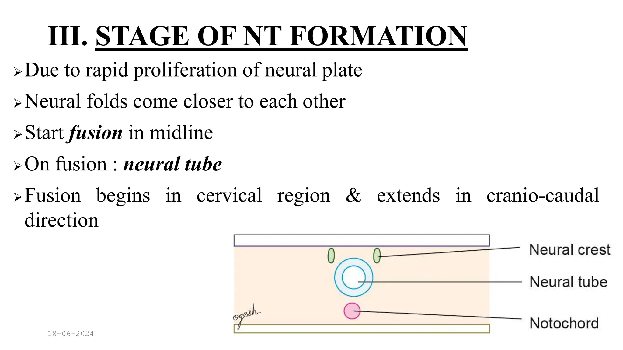 DEVELOPMENT OF NEURAL TUBE & SPINAL CORD.pptx