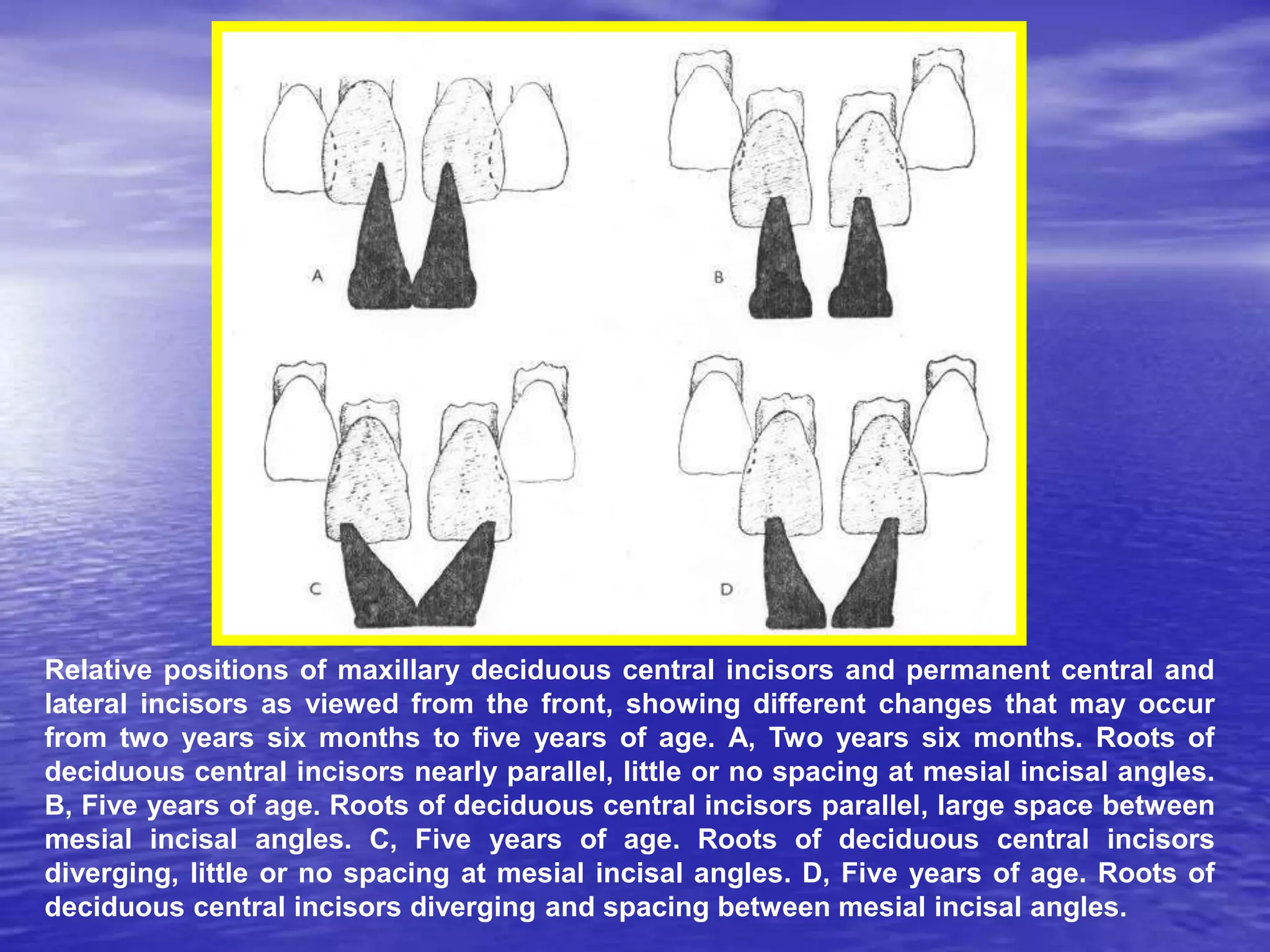 Development of normal dentition and occlusion | PPT